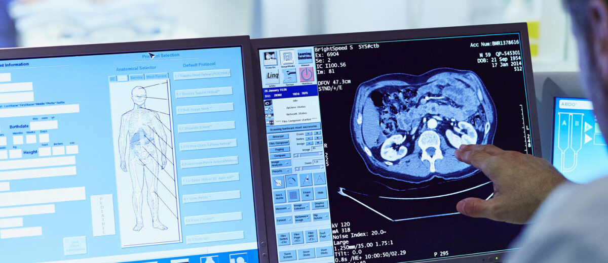 Simulation Drives Increasing Value in the Med-Tech Industry